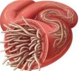 Que Es el Parasitos de Oxiuros en los Humanos y Cual es su Tratamiento