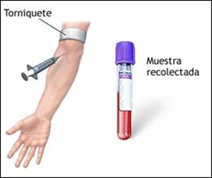 Que Significa Nitrogeno De Urea En Sangre - manualprobit